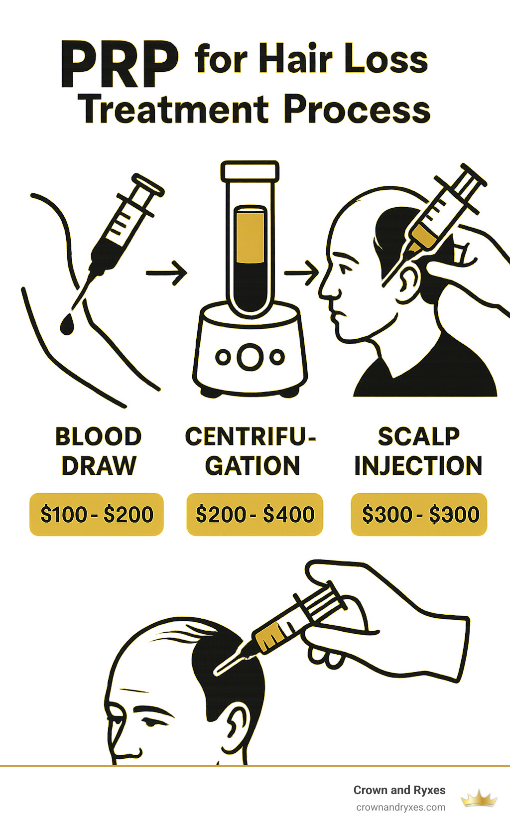 prp injection for hair loss price: 7 Key Costs & Best Value 2025