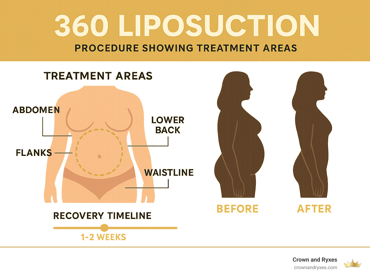 360 liposuction: 7 Powerful Benefits for Stunning Results 2025