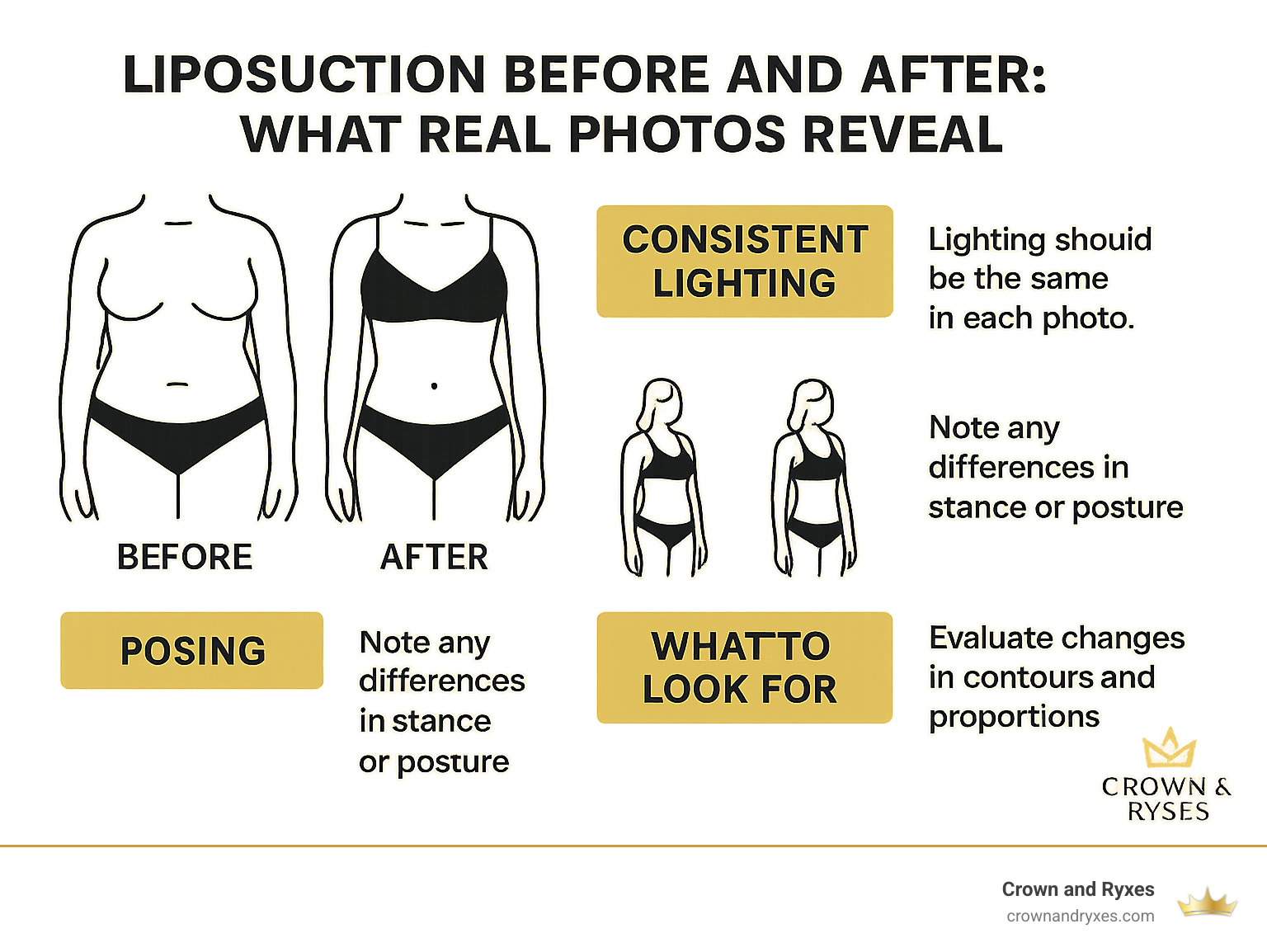 Liposuction before and after: 7 Stunning Results 2025