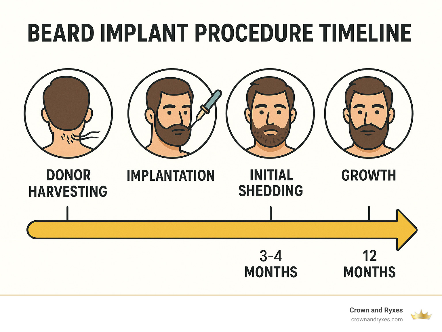 What Are Beard Implants? 7 Powerful Facts for Confident 2025