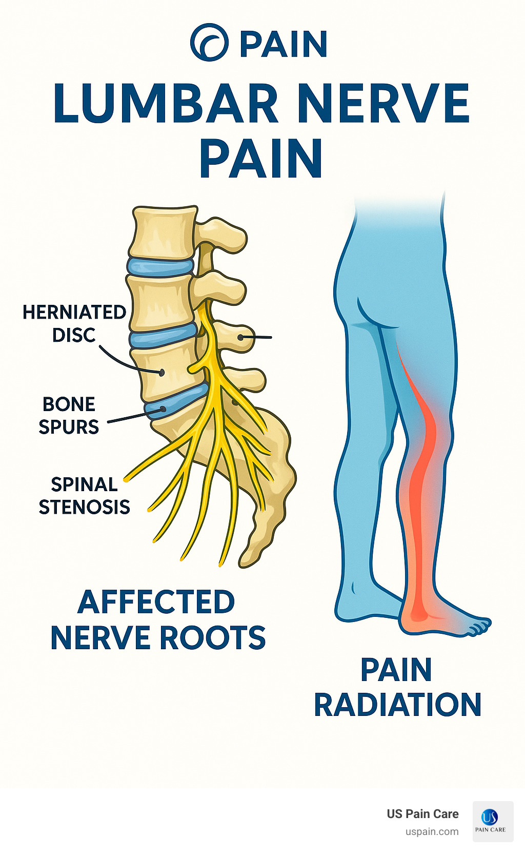 Lumbar Nerve Pain Relief: 6 Powerful Ways For Fast Results 2025