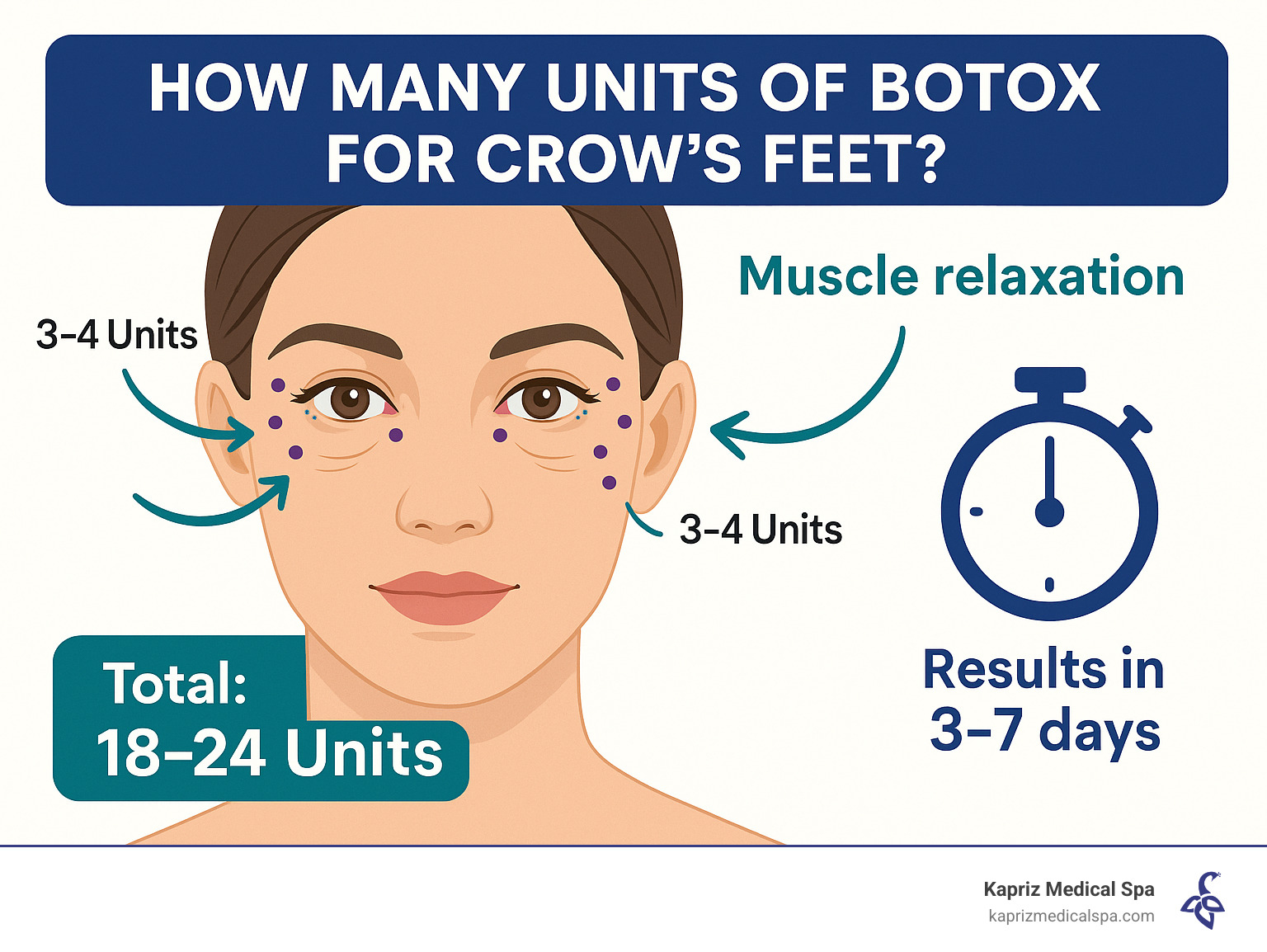 How Many Units of Botox Are Used for Crow's Feet: 7 Powerful Facts 2025