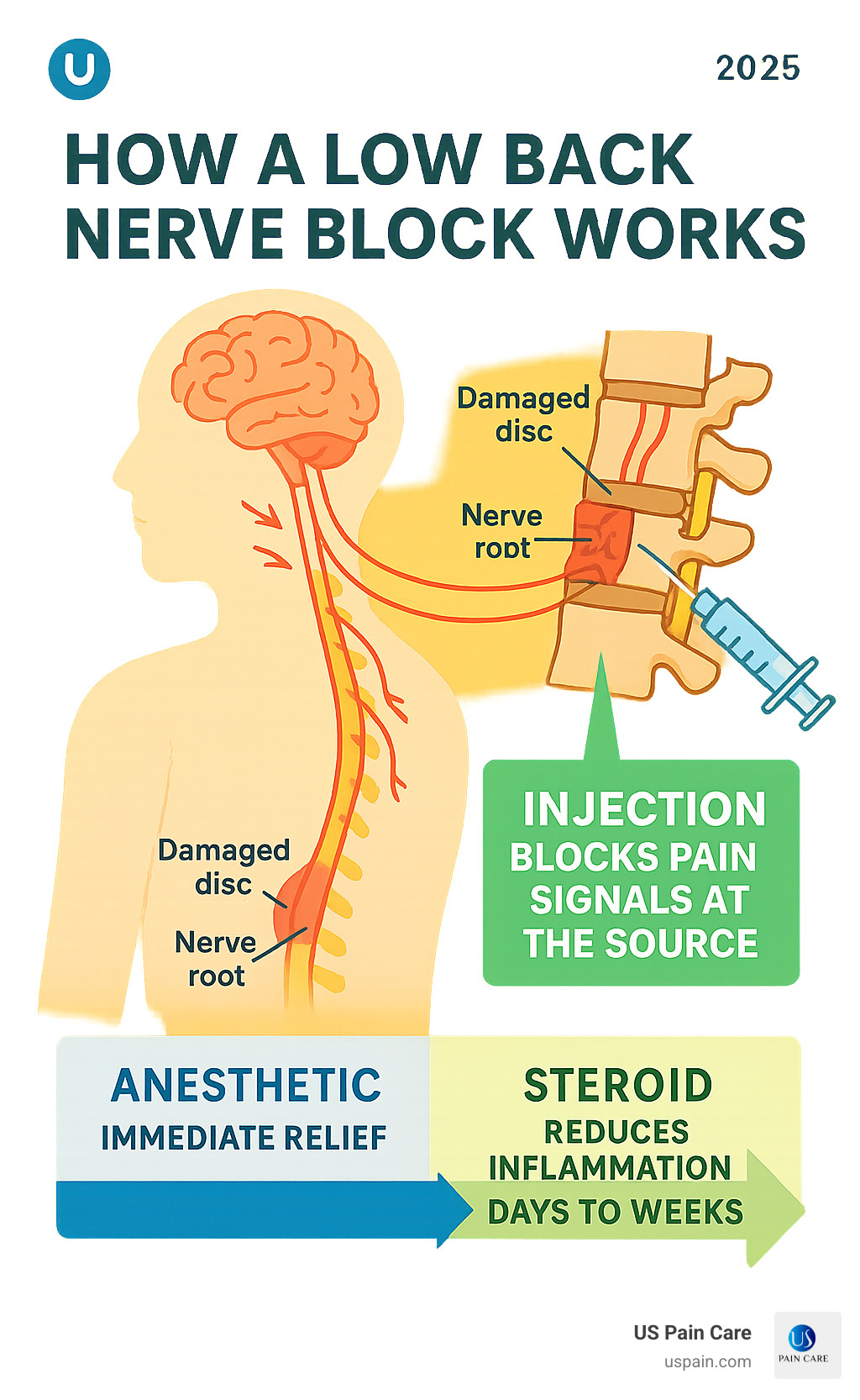 Low Back Nerve Block: 7 Powerful Benefits In 2025