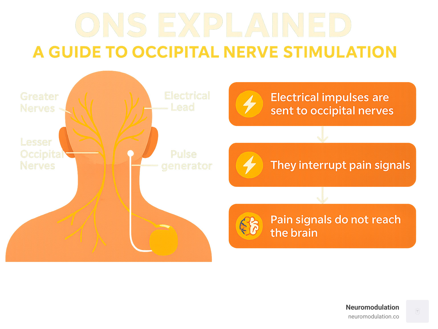 Occipital Nerve Stimulation: 2025 Breakthrough