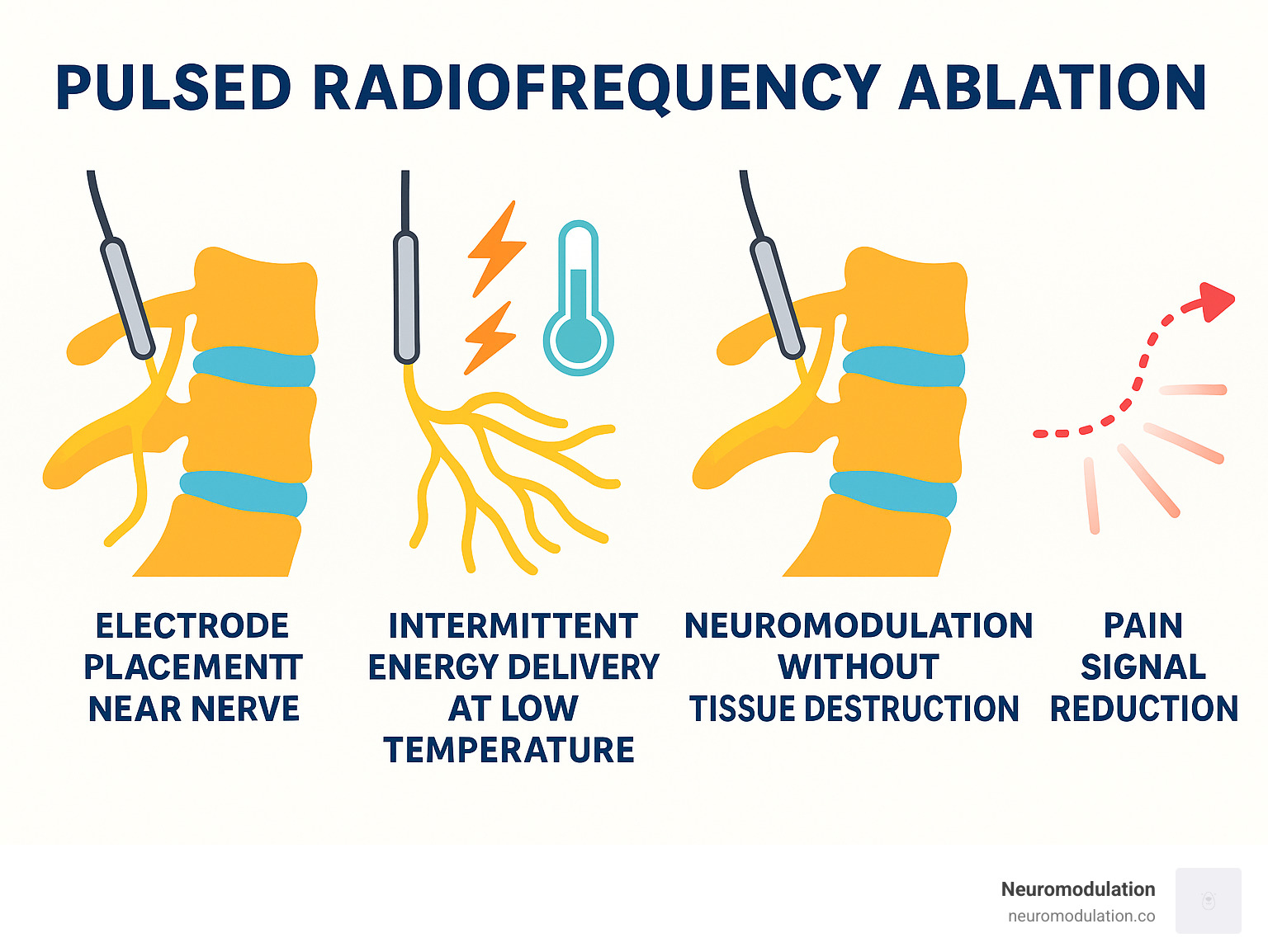 Pulsed radiofrequency ablation: The #1 Gentle Power