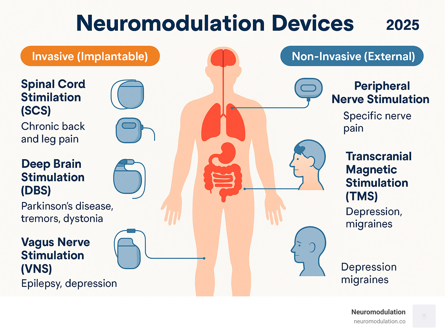 Neuromodulation Devices: 2025 Ultimate Hope