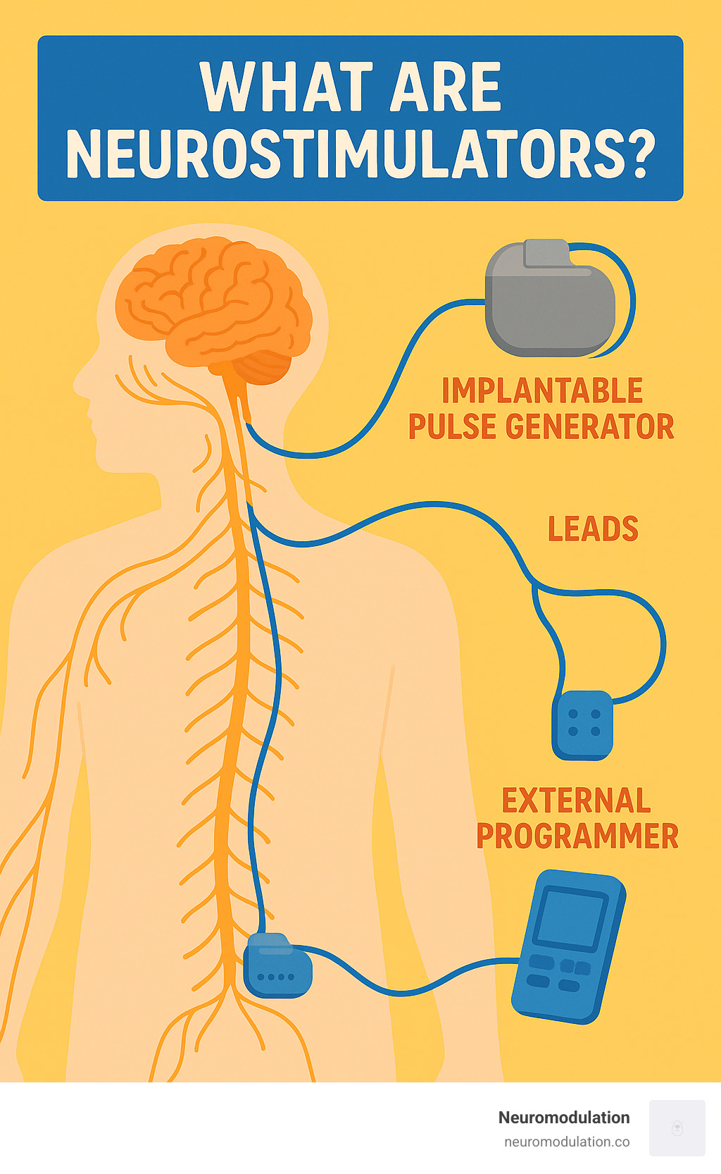 What are neurostimulators? Revolutionary Relief 2025