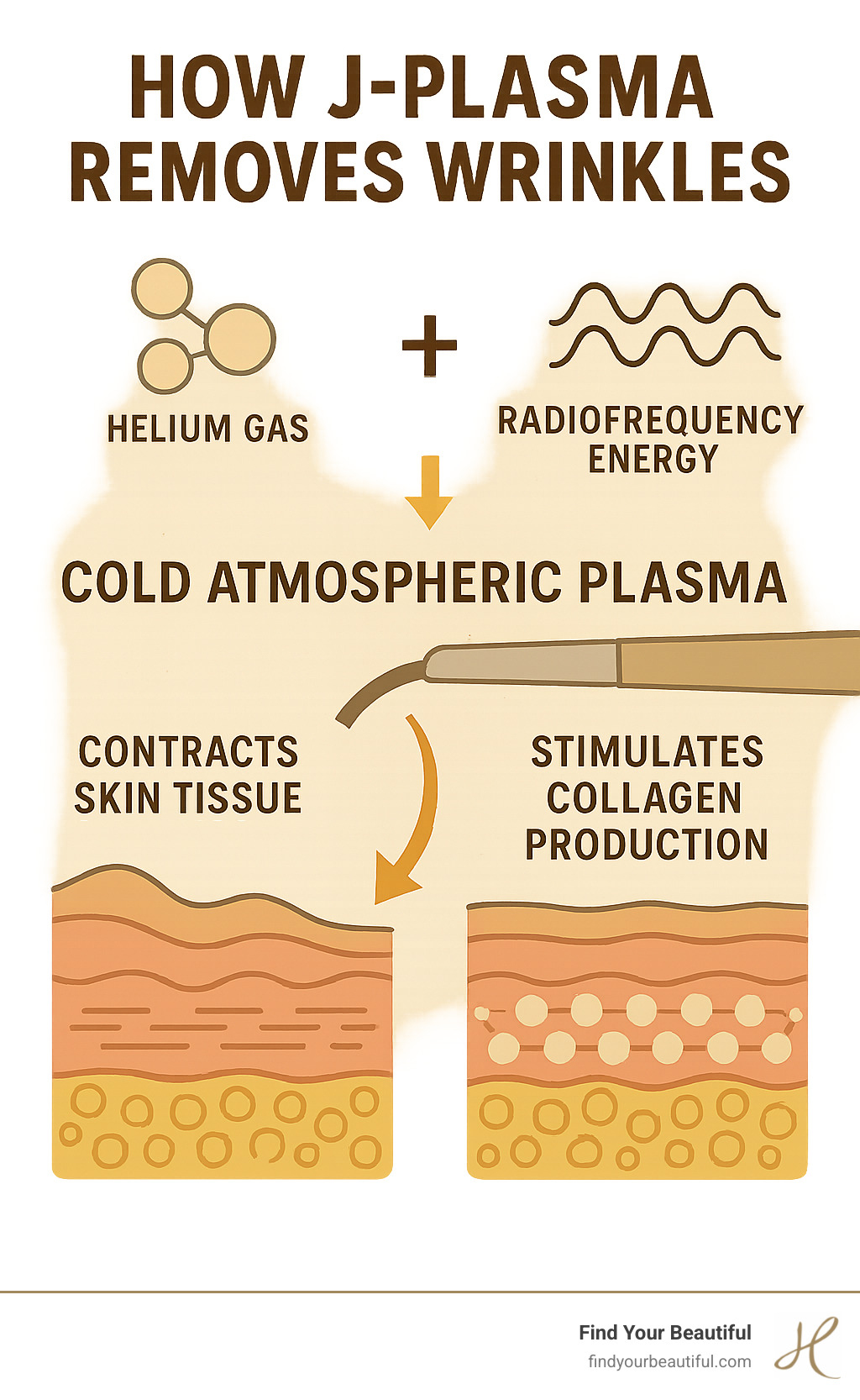 Does J-Plasma Remove Wrinkles: 1 Amazing Solution