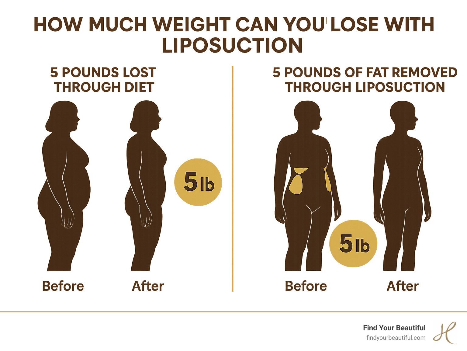 How much weight can you lose with liposuction: 5L Real Gain