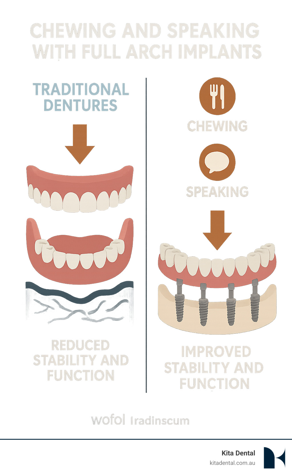 Chewing and speaking with full arch implants: 3 Master Tips!