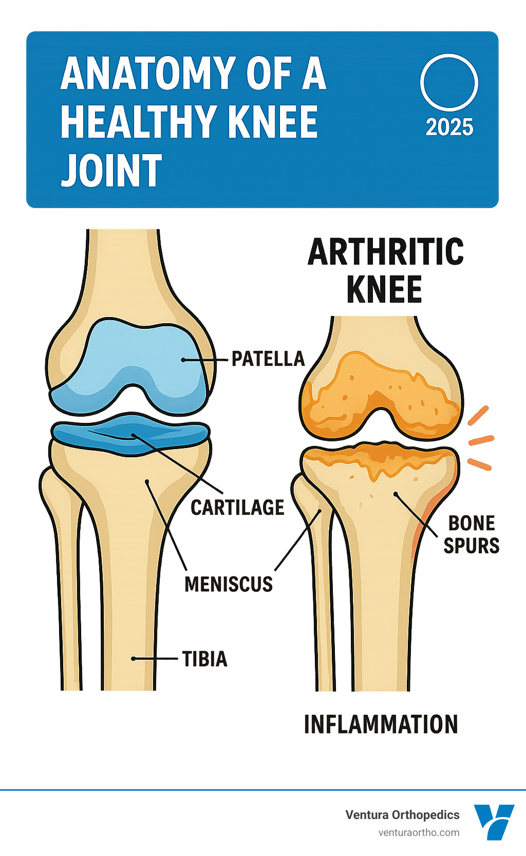Understanding Knee Surgery: A Patient’s Guide