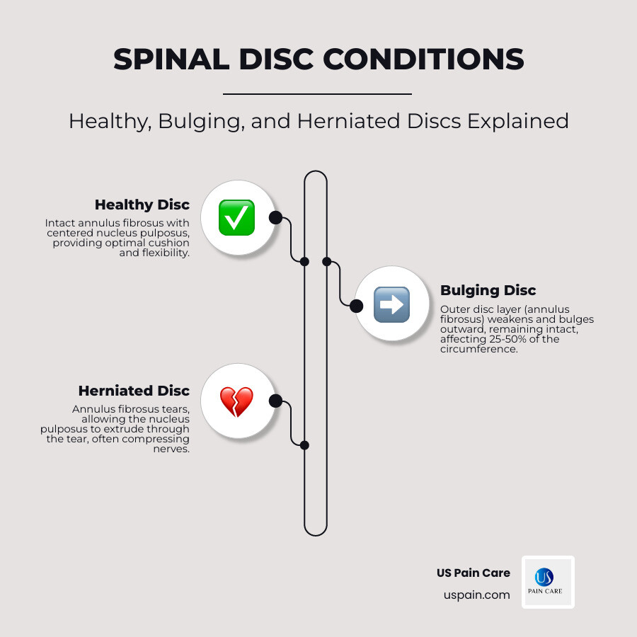 Bulging Disc: 2025 Pain Relief Guide