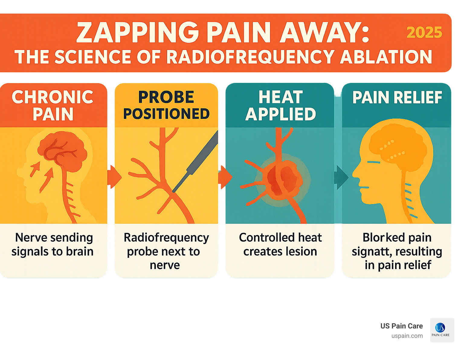 Radiofrequency Ablation Pain Relief: #1 Hope
