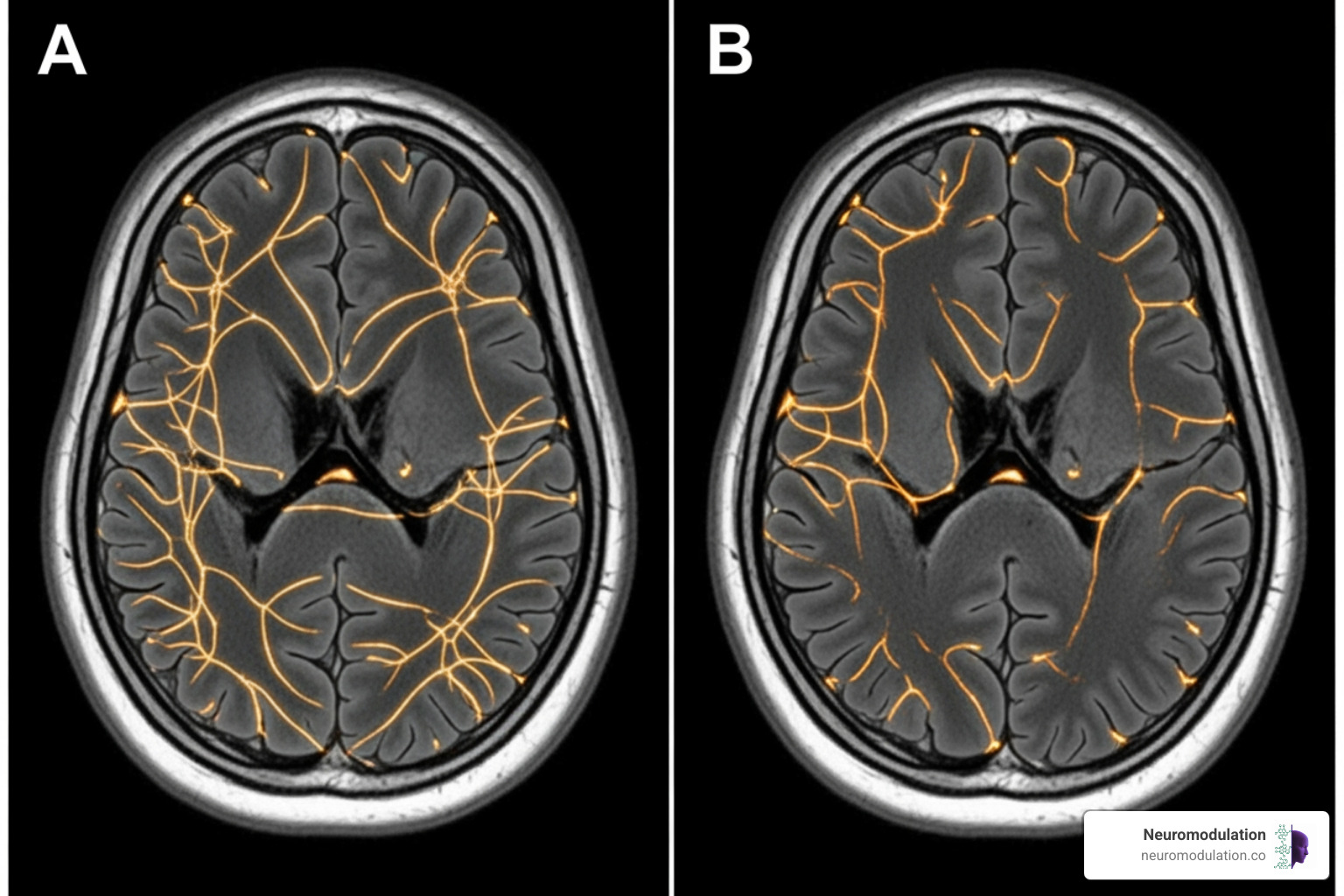 Non Invasive Neuromodulation: 2025 Breakthrough