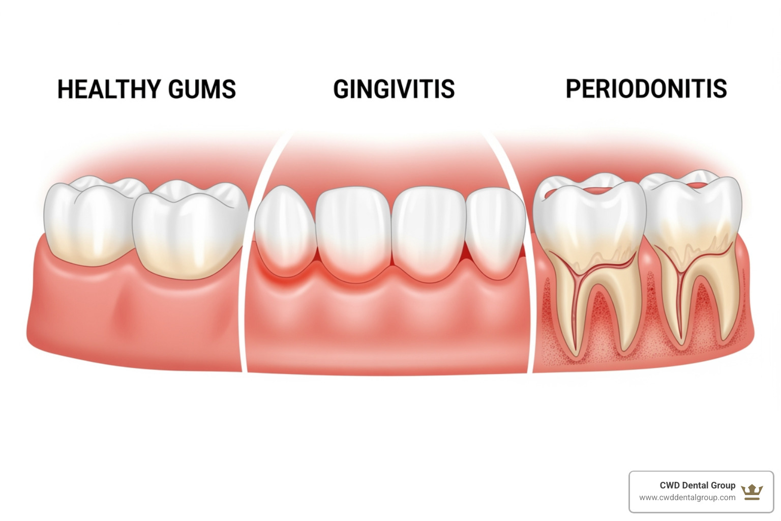 Gutka stain remover from teeth: Ultimate 2025 Guide — CWD Dental Group