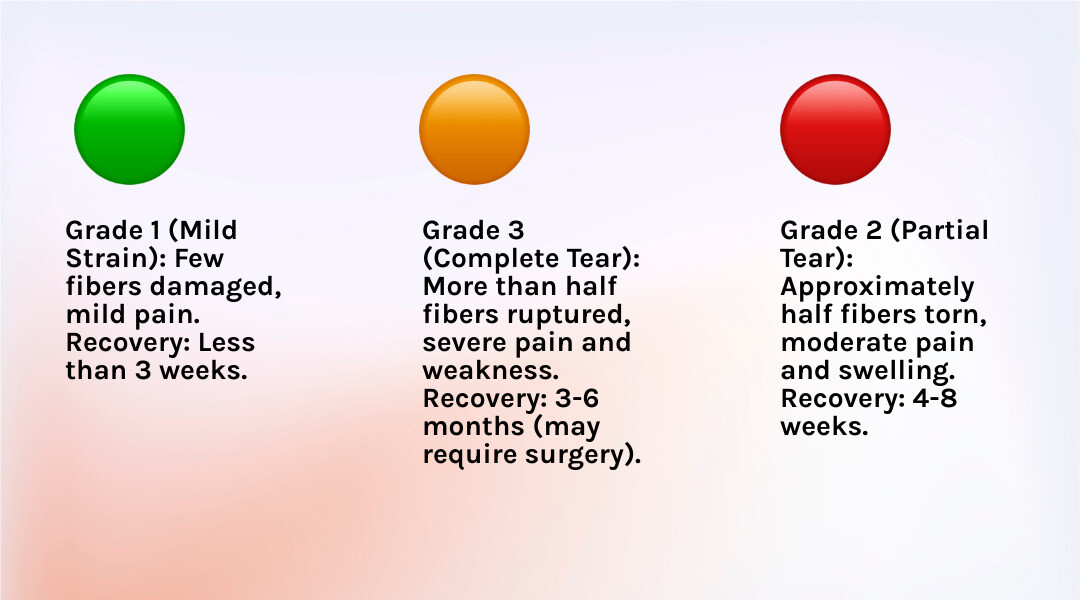 Rehabbing a torn hamstring: 3 Effective Phases – Neuropasil