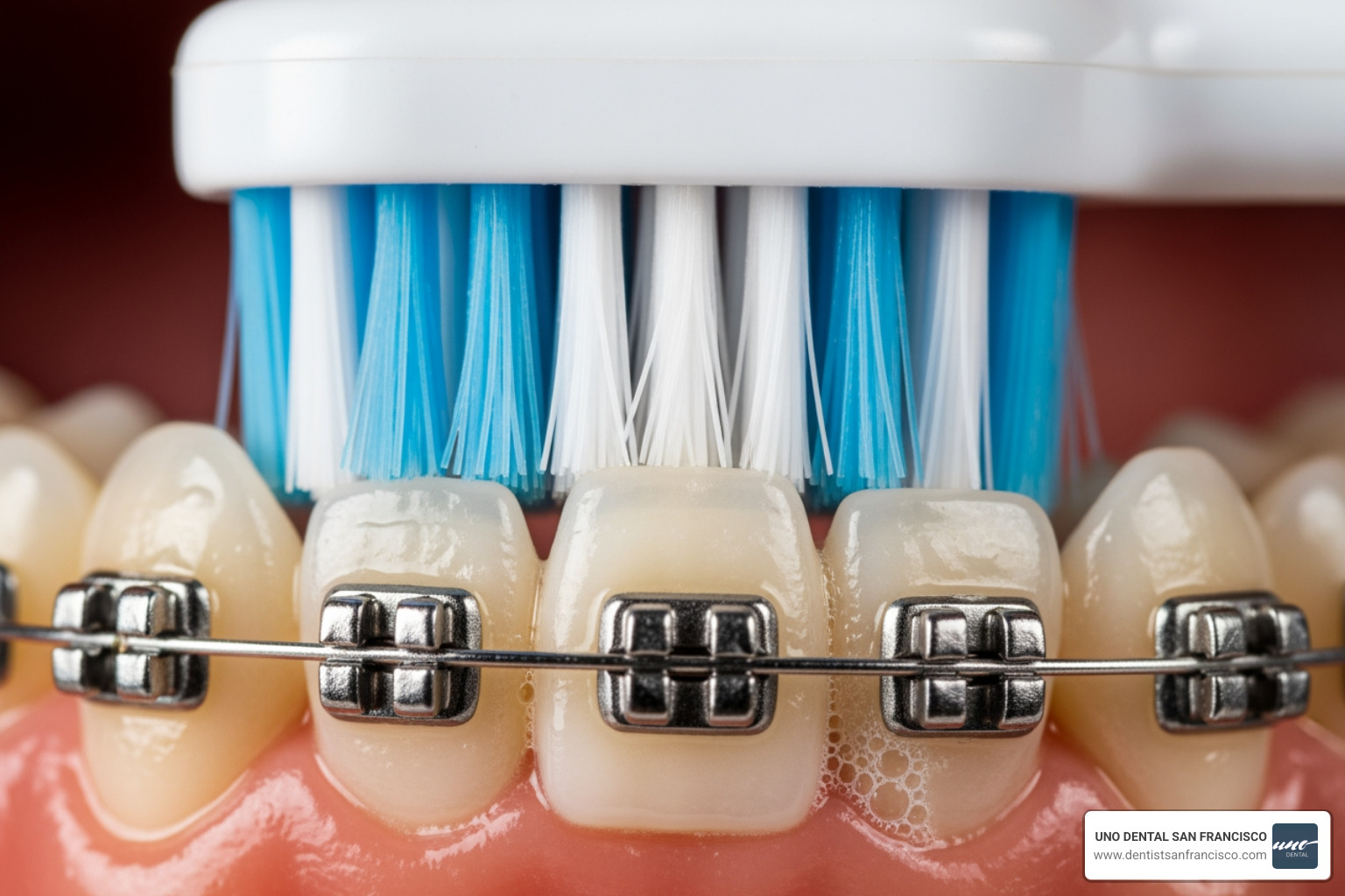 Best Electric Toothbrush: Supreme Clean 2026