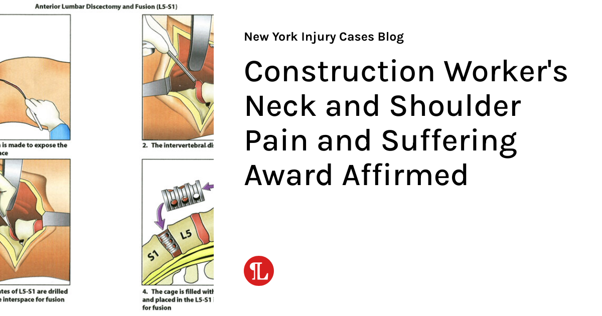Construction Worker's Neck and Shoulder Pain and Suffering Award ...