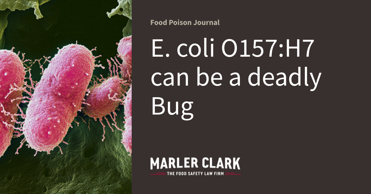 E. coli O157:H7 can be a deadly Bug | Food Poison Journal