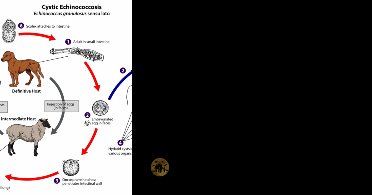 Infection control for alveolar echinococcosis (non-gastrointestinal ...